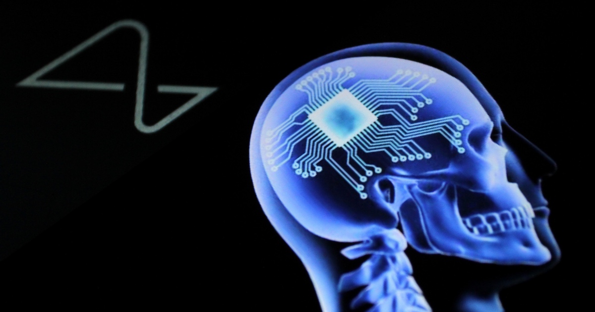 Elon Musk says patient moves cursor with brain implant • PhilSTAR Life