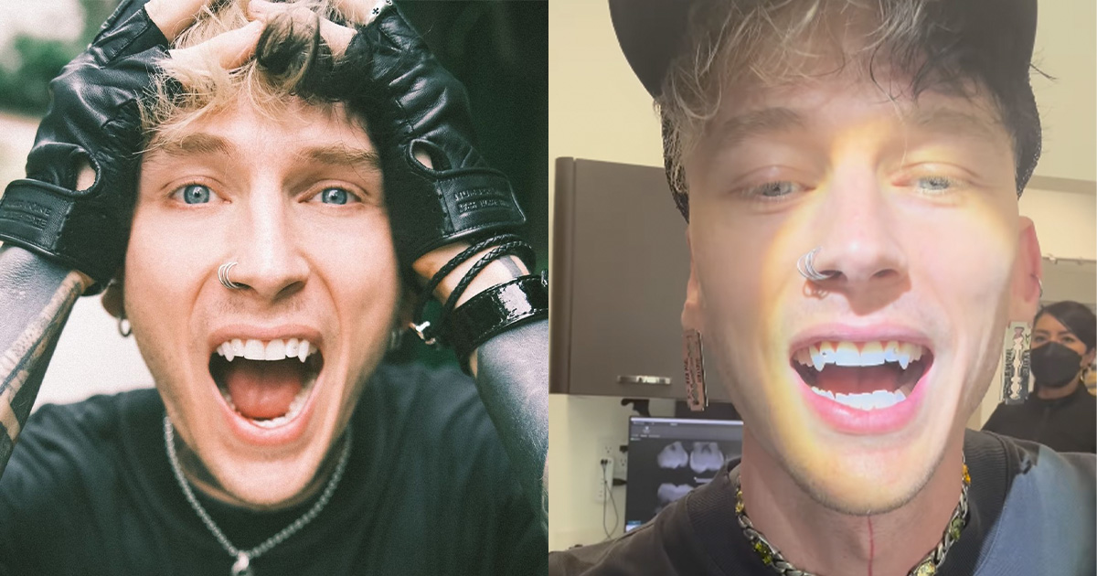 Machine Gun Kelly shows off his new fangs: 'Might need 'em sharpened ...