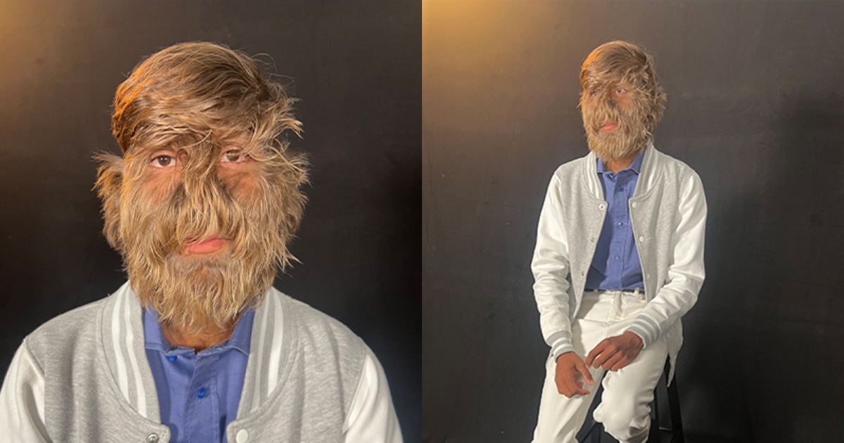 18-year-old Indian sets Guinness World Record for hairiest face ...